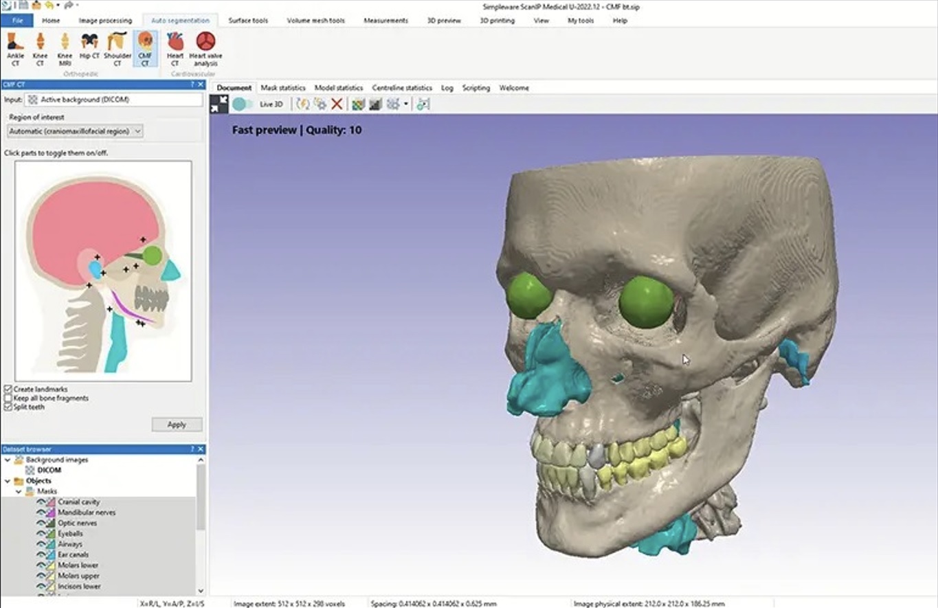 Synopsis stellt neue Version Simpleware U-2022.12 vor