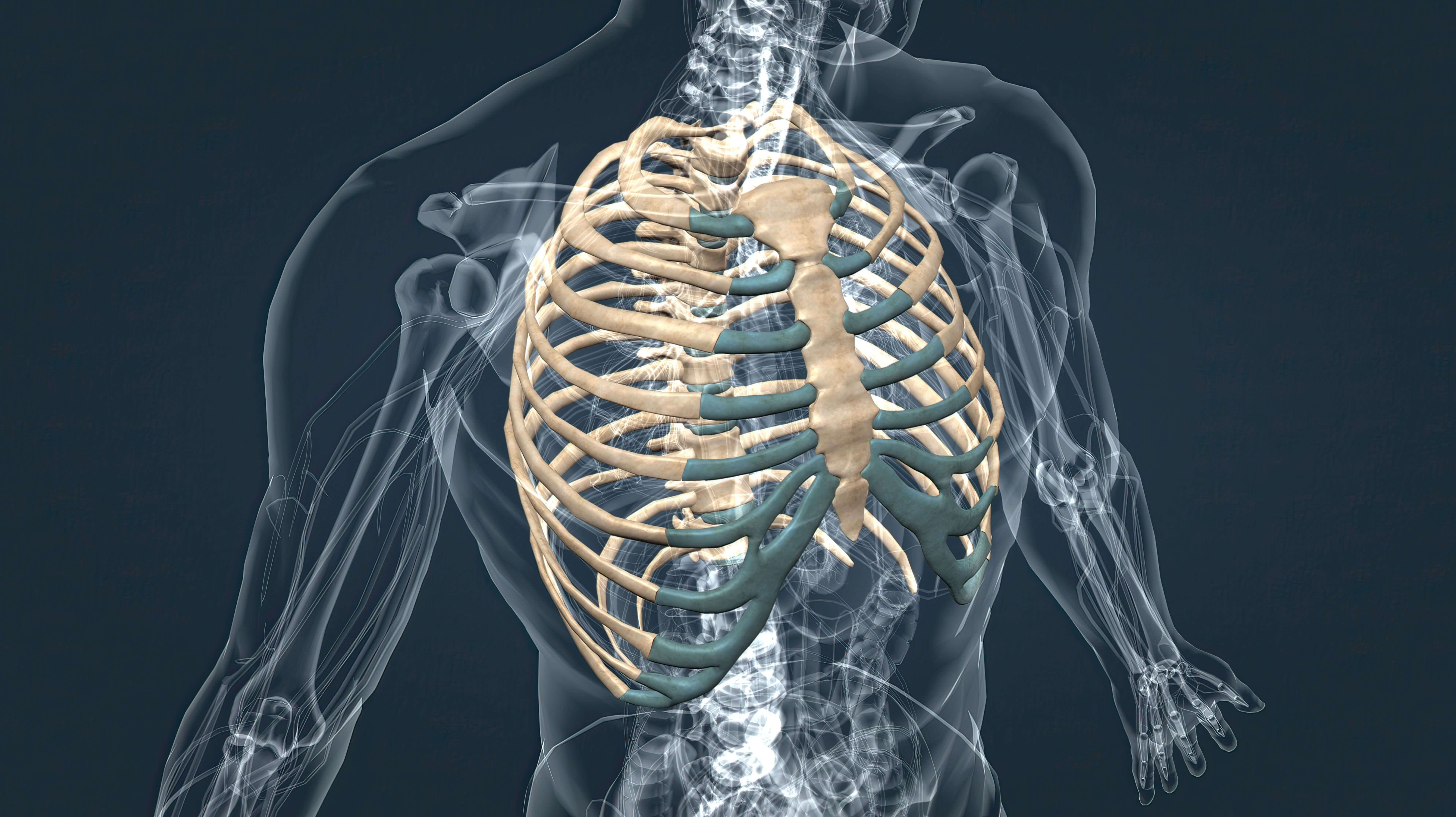 3D-gedruckte Ersatzrippen versprechen Brust- und Lungenkrebspatienten ...