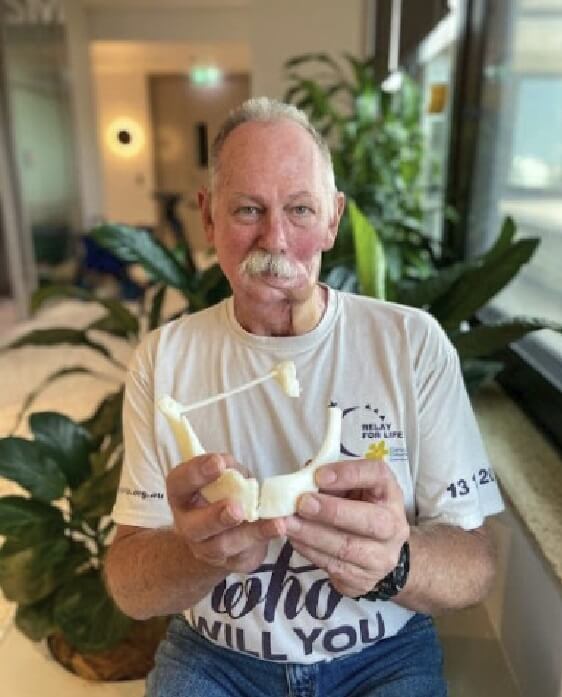 Knochen wächst dank bioresorbierbarem 3D-Druck-Kieferknochenimplantat ...